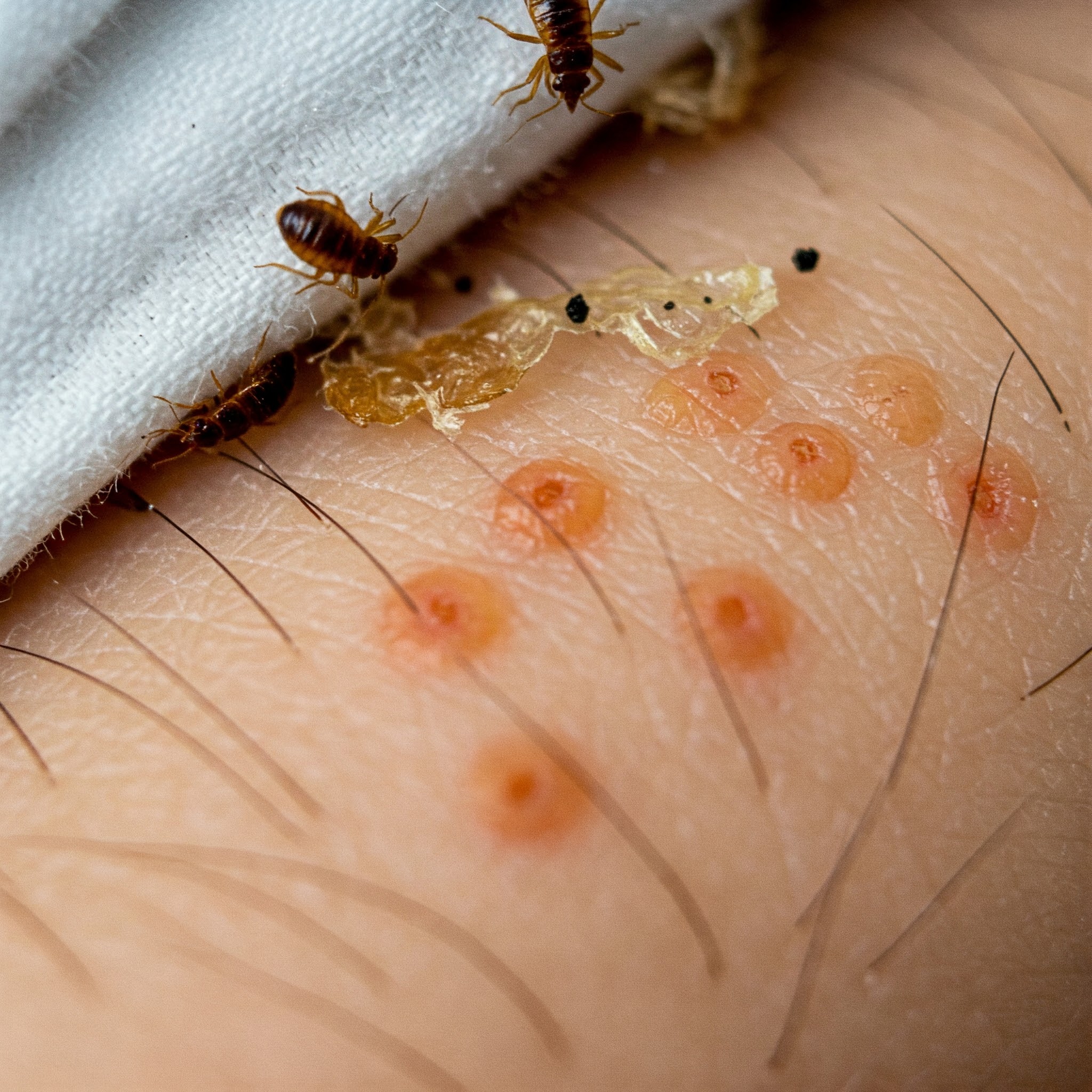 Are You Sure It's Bed Bugs? 5 Surprising Signs of Bed Bugs